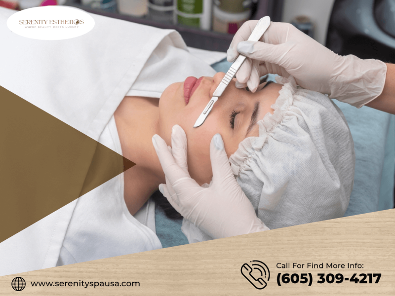 Discover the Benefits of Dermaplane Treatment at Sioux Falls Spa
